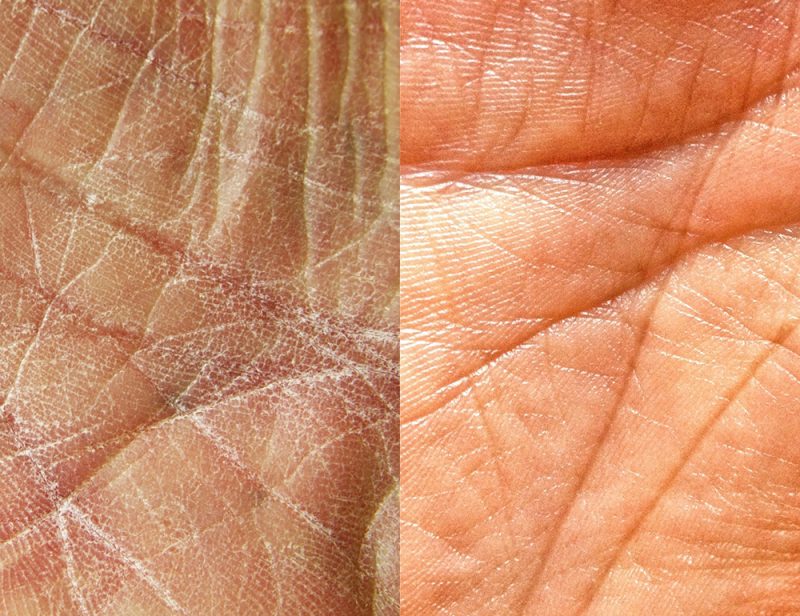 Mani secche e rugose? Ecco i rimedi! - BeOnMe