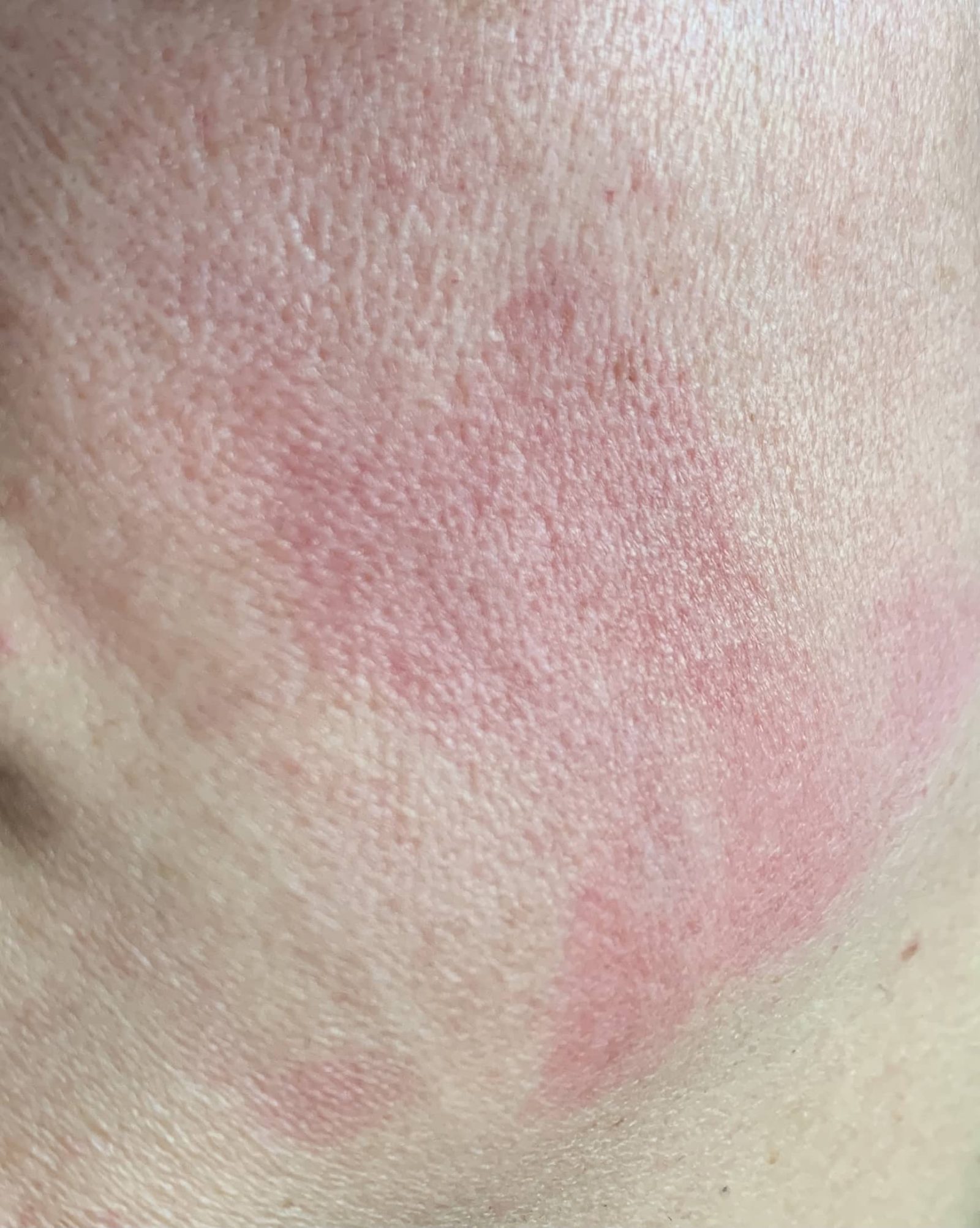 Skincare routine for sensitive skin - BeOnMe