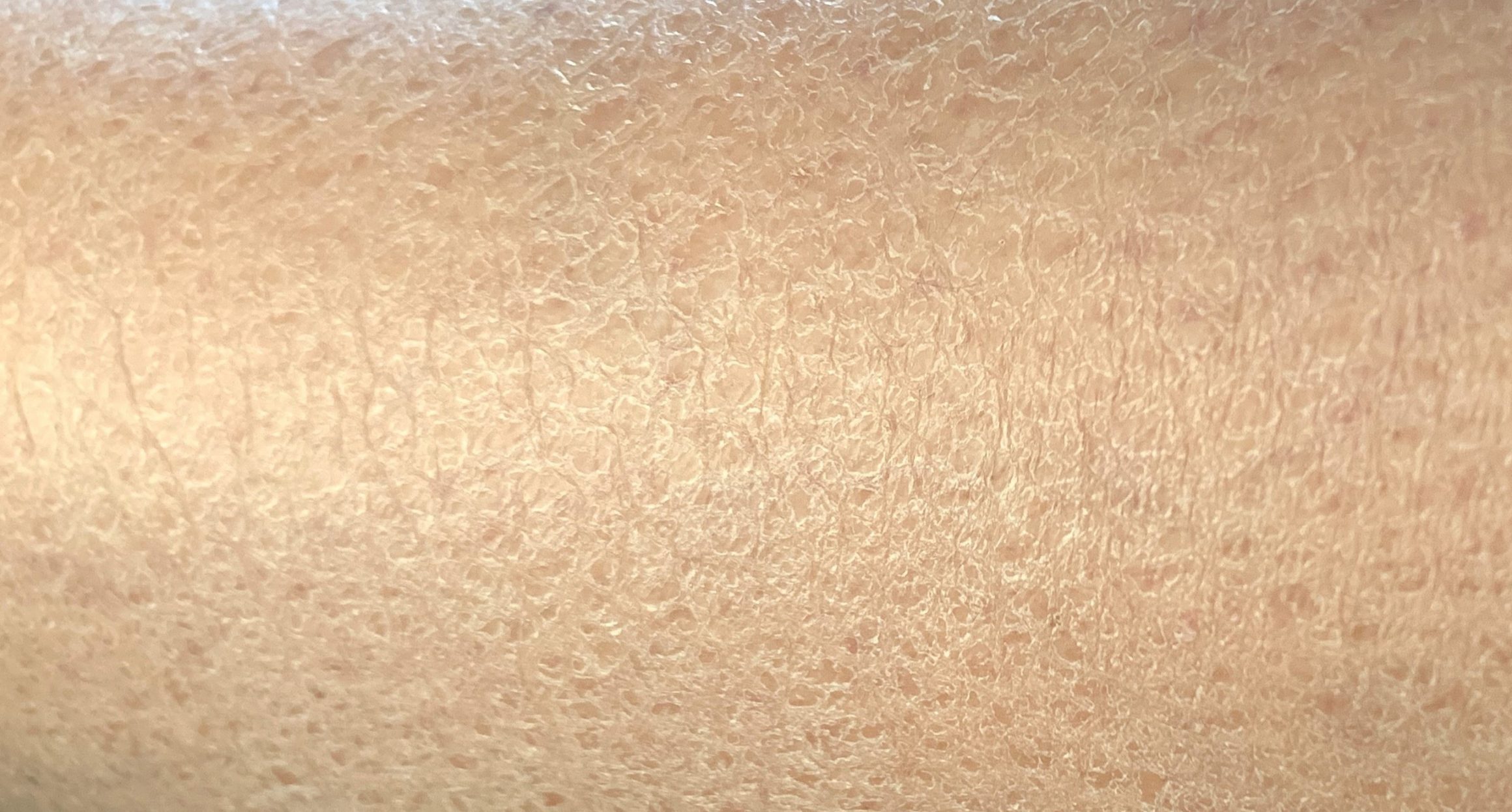 How to have beautiful legs - BeOnMe